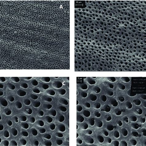 Dentin Disc With Desensitizing Agents Download Scientific Diagram
