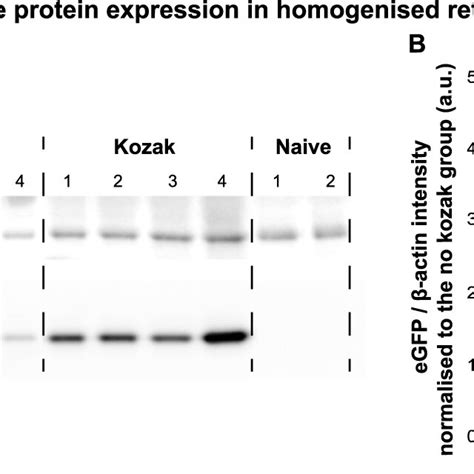 The Effect Of The Kozak Consensus Sequence On Egfp Protein Expression