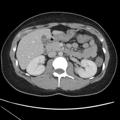 Ultrasound Imaging Of The Gallbladder Showing Multiple Septations Download Scientific Diagram