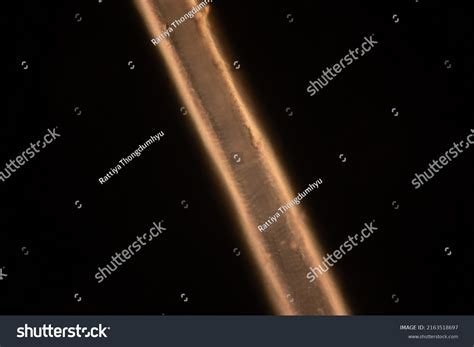 Scalp Hair Follicles Human Under Microscope Stock Photo 2163518697 Shutterstock