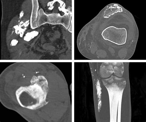 Ct Quick Guides Ct Scanning