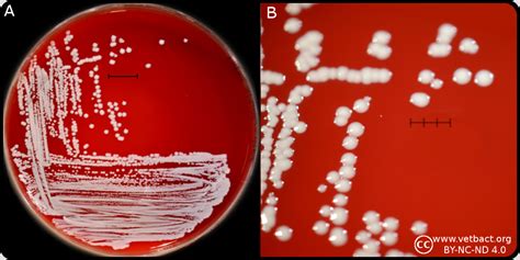 Staphylococcus Saprophyticus Subsp Saprophyticus