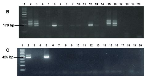 Representative Image Of Nested Pcr Amplified Products Using Primers Download Scientific Diagram
