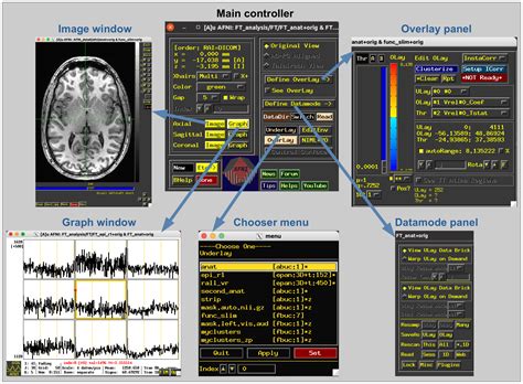 5 1 8 Afni Gui Maps — Afni Suma And Fatcat V25 2 18