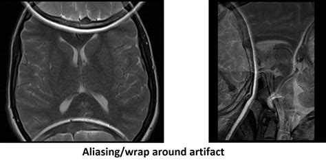 Aliasing Wrap Around Artifact