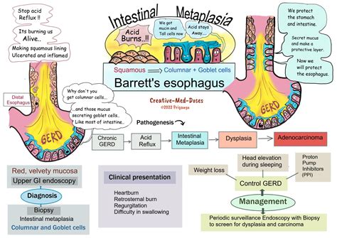 Barretts Esophagus Creative Med Doses