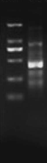 Electrophoretogram Of Amplification Product Of Mulberry Download