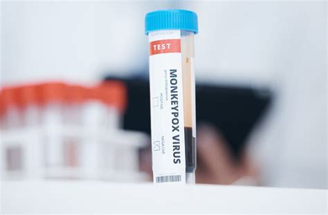 Unveiling Australias Fastest Next Gen Mpox Diagnostic Tool Doherty Website