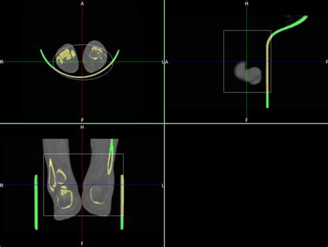 vtk中基于vtkpolygon延伸成柱状体的实现 vtkinteractorstyledrawpolygon csdn博客