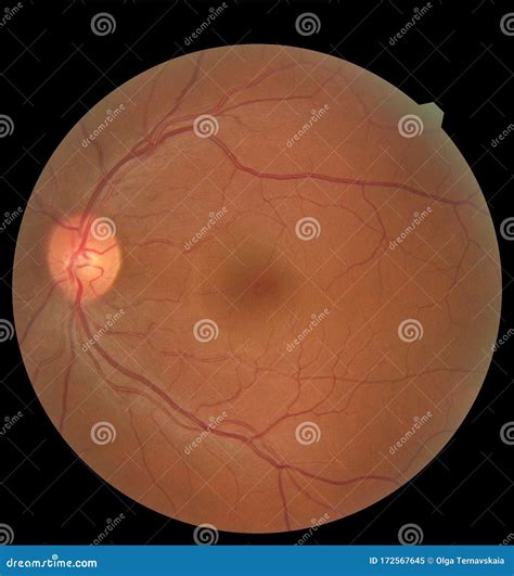 View Inside Human Eye Showing Retina Optic Nerve And Macula Health