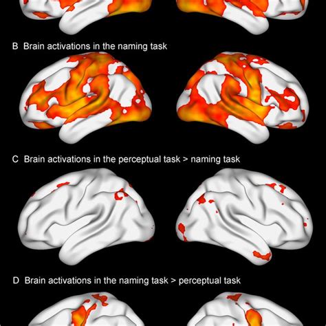 Task Modulates The Orthographic And Phonological Representations In The