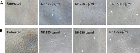 Morphological Features Of Apoptotic Cells Observed After The Treatment
