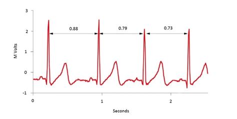 Understanding Heart Rate Variability Hrv And Its Impact On Athletic Performance European