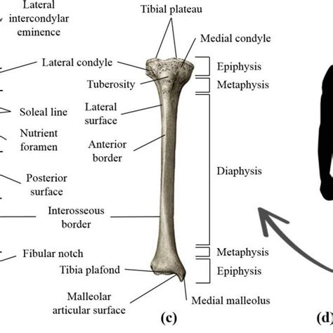 1 Representation Of The Tibia Positioning In The Lower Leg D With