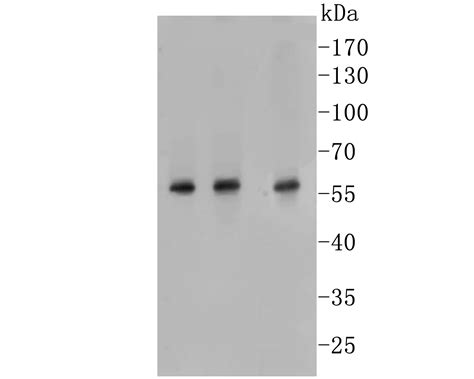 Pten Rabbit Polyclonal Antibody Er1902 27 Huabio