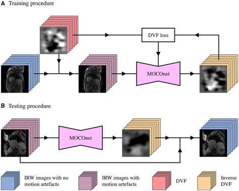 Moconet Robust Motion Correction Of Cardiovascular Magnetic Resonance