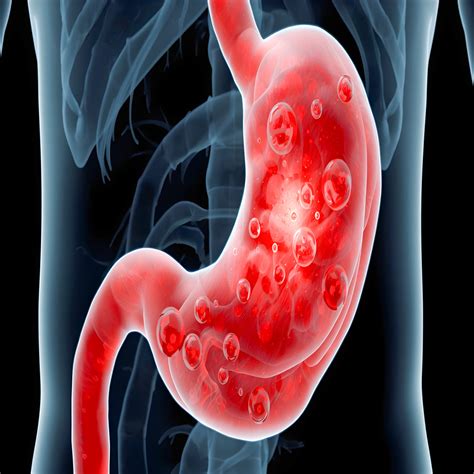 Digestive System Diseases Medical Illustration Bundle Gut Health