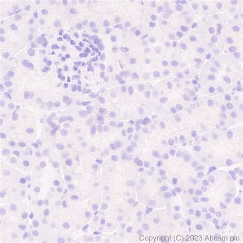 Puromycin抗体 Epr27218 173 Ab315887 Abcam中文官网