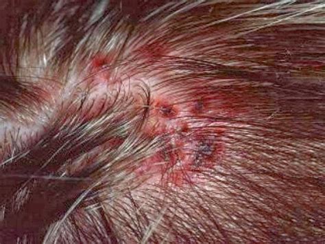 Dermatologia 07 Grupo 05