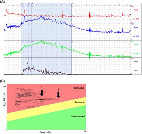 Fundamentals Of Urodynamic Practice Based On International Continence