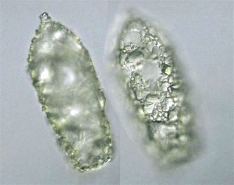 Protist Images Difflugia Acuminata