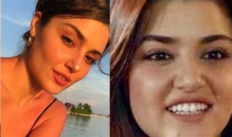 Sen Çal Kapımının Yıldızı Hande Erçelin Estetiksiz Hali Görenleri