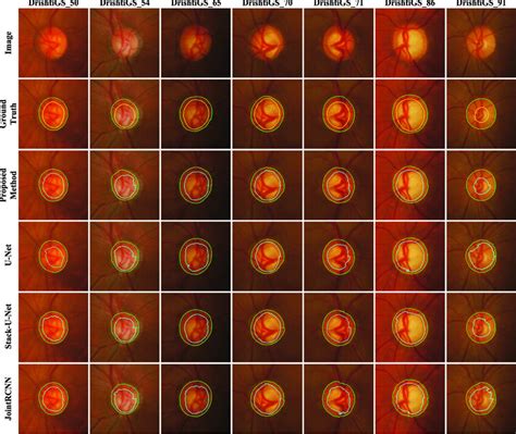 examples of segmentation results of different methods on the