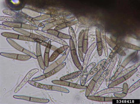 Dry Rot Of Ears And Stalks Of Maize Stenocarpella Macrospora