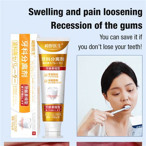 Dental Source Separator Dental Separator Source Shopee Philippines