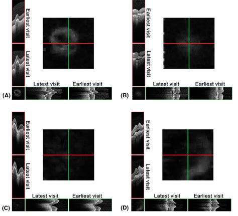 Detection Results Of The Machine Learning Algorithm On Two Consecutive
