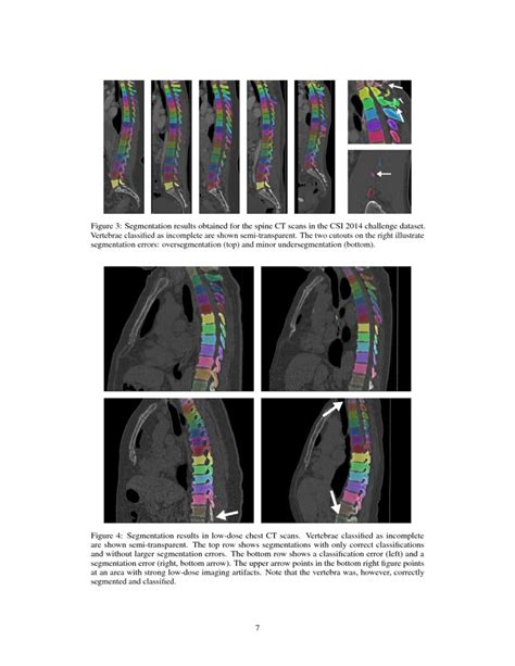 Iterative Fully Convolutional Neural Networks For Automatic Vertebra Segmentation Deepai