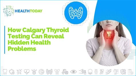 Private Thyroid Testing In Calgary Health Today