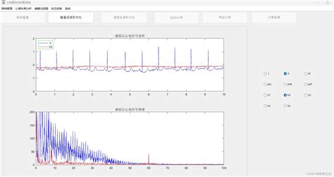 【心电信号】基于matlab gui心电图自动诊断【含matlab源码 3074期】 matlab心电图 csdn博客