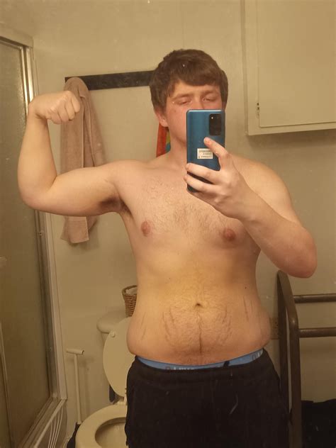 Low T No Exercise Vs Trt Vs Trttraining Rtestosterone