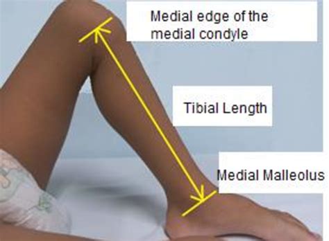 Measurement Of Tibial Length Download Scientific Diagram