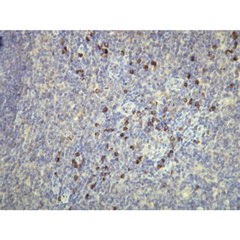 Anti Human Kappa Light Chain Antibody A21 Y A8191