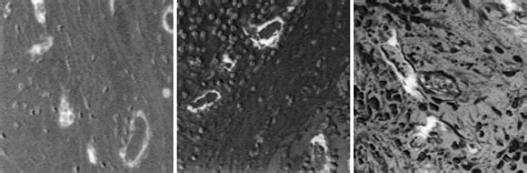 Example Of RGB HSI Transform Download Scientific Diagram