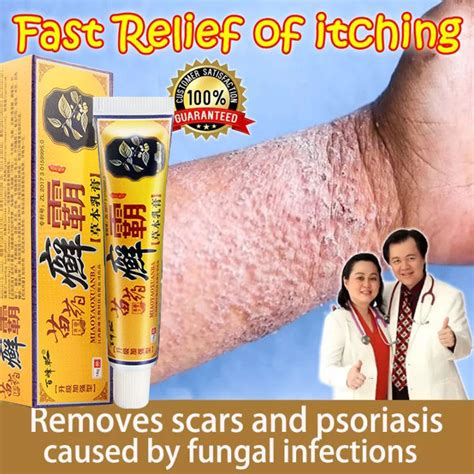 Sumifun Eczema Treatment Cream Atoderma Cream Original Gamot Sa Kati Kati Sa Balat Ointment