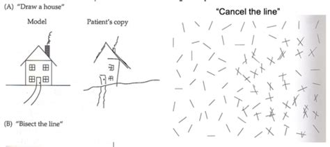 Sensorimotor Final Exam Flashcards Quizlet