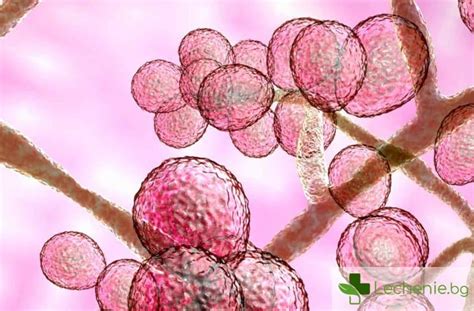 ᐉ Кандида какво представлява и как да я лекуваме — Lechenie Bg