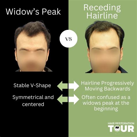 What Is A Widows Peak Definition Genetics And Cultural Significance