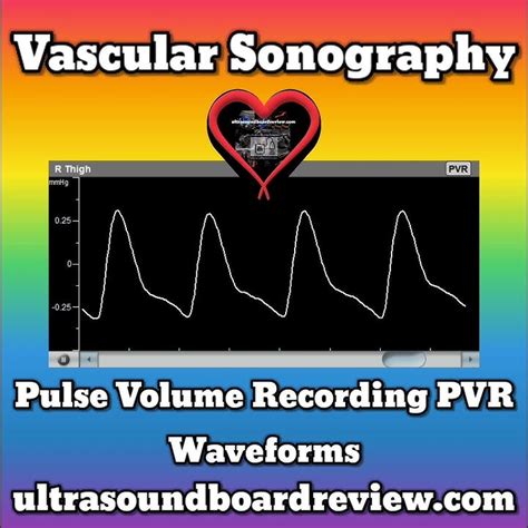 Pulse Volume Recording Waveforms Youtube