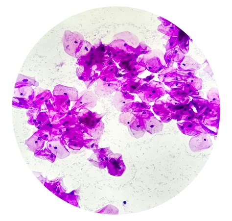 Premium Photo Papas Smear Cytology Slide Microscopic Show Squamous