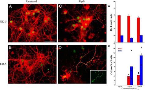 Differential Cell Survival Of Tbr 1 Positive Populations After A