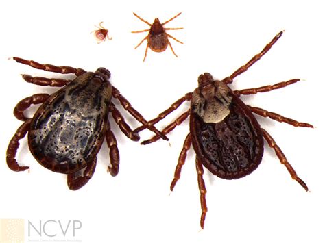 Dermacentor Variabilis Microscope