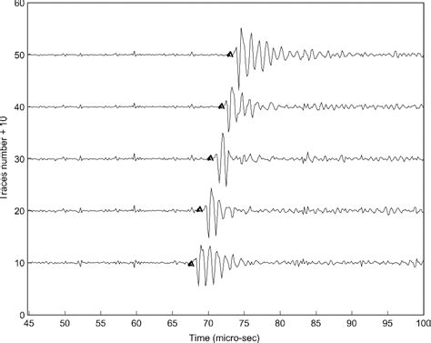 Figure 1 From An Improved Automatic Time Of Flight Picker For Medical