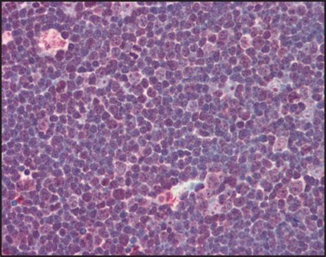 Anti Il31 Ab2 Antibody Produced In Rabbit