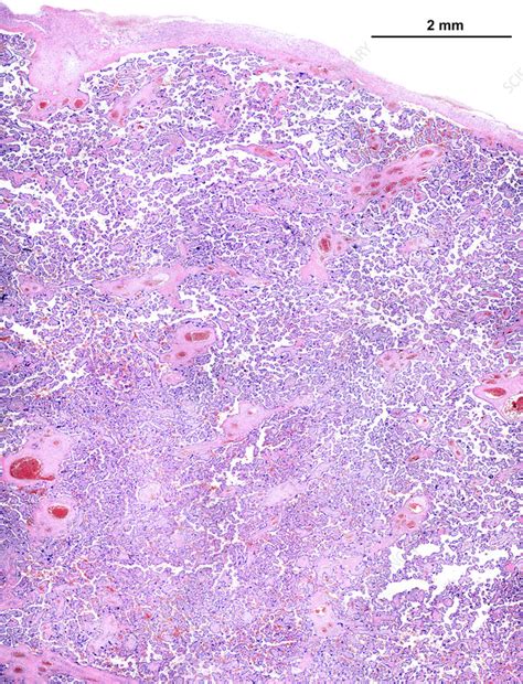 Human Placenta Light Micrograph Stock Image C0563700 Science