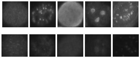 Classification Of Hep 2 Staining Pattern Images Using Adapted Multilayer Perceptron Neural