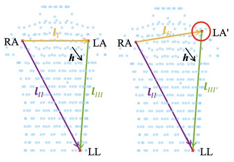 a lead vectors of the 12 lead ecg system b limb electrode move